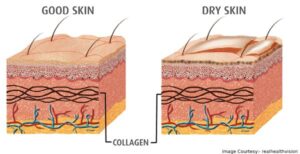 Dry Skin Rash: Its Causes And 9 Tips To Soothe It Very Fast